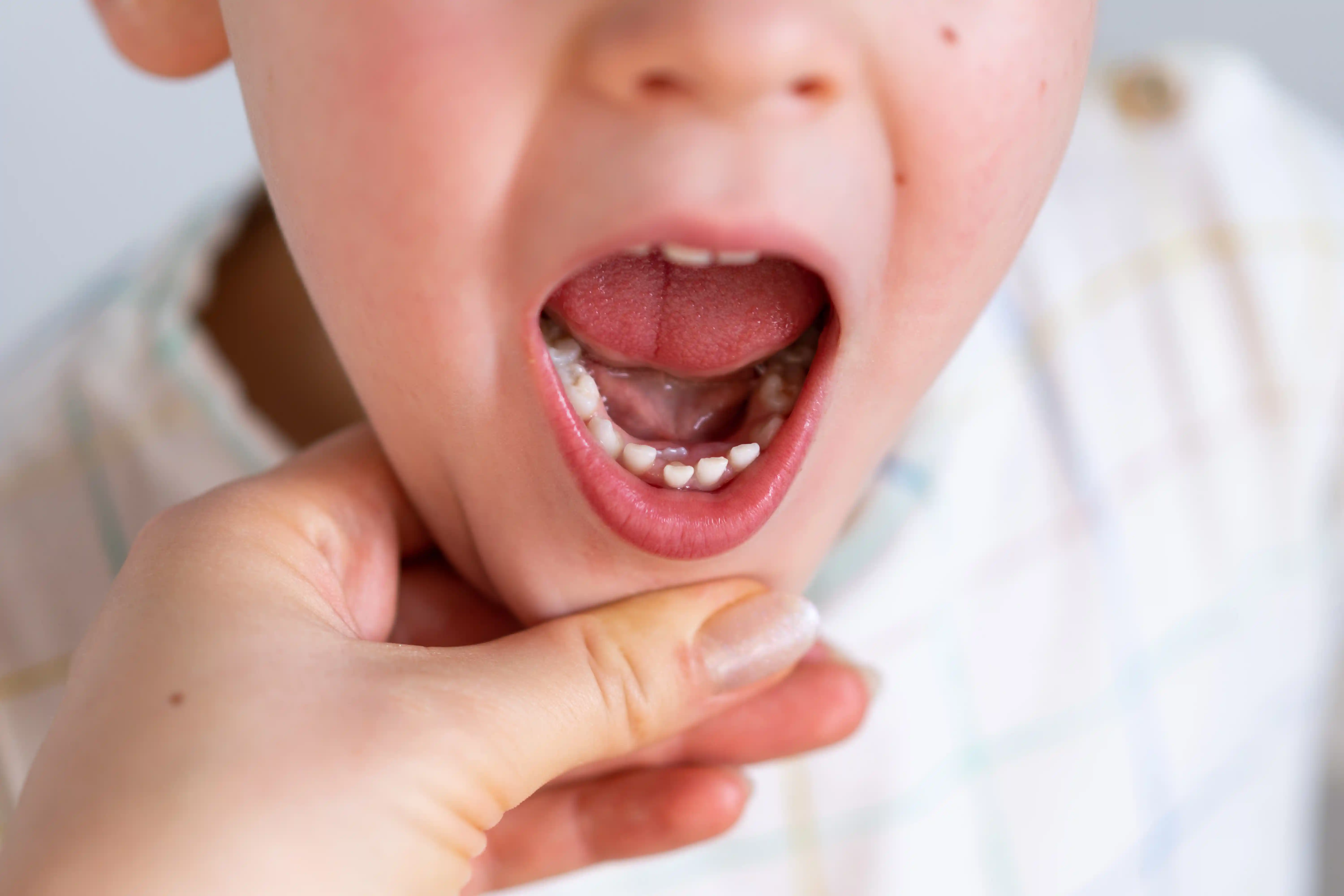 Do Baby Teeth Have Stem Cells? Insights from Little Smiles